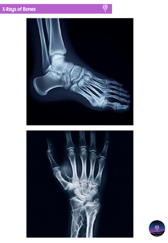 The Human Skeleton - Outstanding KS2 Science Lesson | Teaching Resources