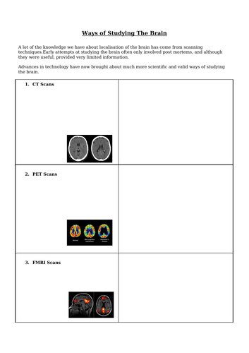 AQA GCSE Psychology - The Brain & Neuropsychology [Full Topic ...