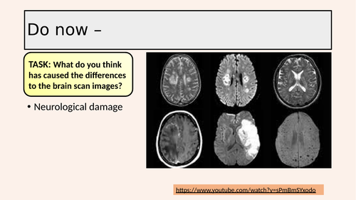 Edexcel GCSE Psychology - The Brain and Neuropsychology - The impact of ...