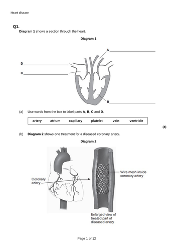 AQA GCSE Biology The heart (full set of resources) | Teaching Resources