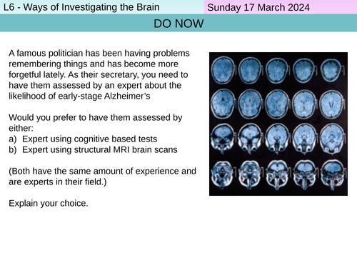 L6: Ways Of Investigating The Brain - Biopsychology - AQA Psychology ...