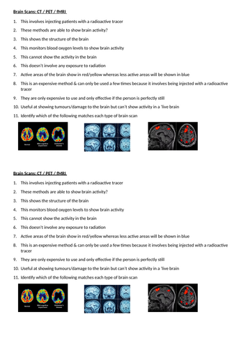 Neuropsychology& Brain Scans GCSE Psychology | Teaching Resources