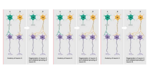 AQA A Level Psychology - Biopsychology - Plasticity and functional ...