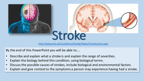 BTEC Health & Social Care Unit 3 Anatomy & Physiology B2 Cardiovascular ...