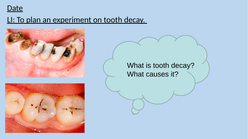 Tooth Decay Experiment LKS2 | Teaching Resources