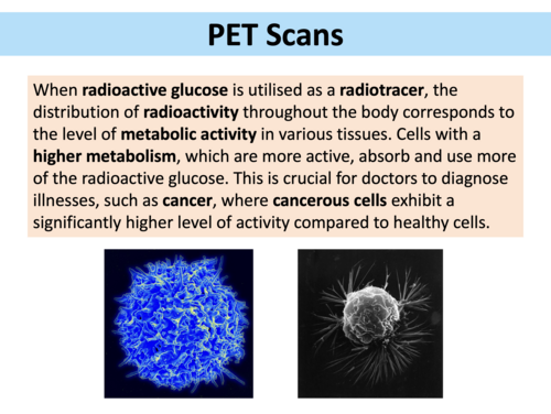 Medical Uses of Nuclear Radiation - A Level Physics | Teaching Resources
