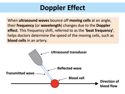 Medical Uses of Ultrasound - A Level Physics | Teaching Resources
