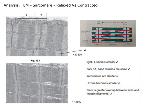 OCR A Level Biology - Muscles and Nervous System | Teaching Resources