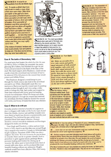 Health and the People: Lesson 5/6: How good was medieval surgery ...