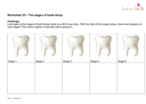 The stages of tooth decay | Teaching Resources