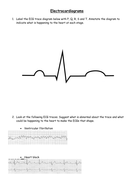 Electrocardiograms worksheet | Teaching Resources