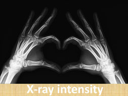 X-ray intensity by Mister_Dawg | Teaching Resources