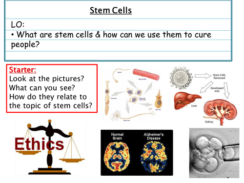 Stem Cells | Teaching Resources