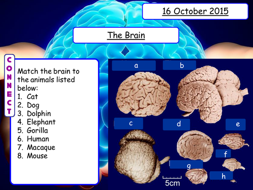 Brain Dissection Lesson | Teaching Resources